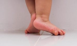 Toe Walking Treatment Melbourne | Causes & Symptoms